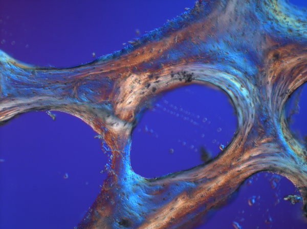 Gratis stock foto's - Rgbstock - gratis afbeeldingen | Poreus bot 1 ...